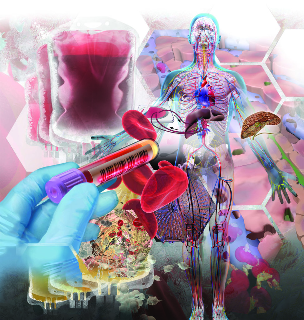 Linda Nye for Transfusion Journal